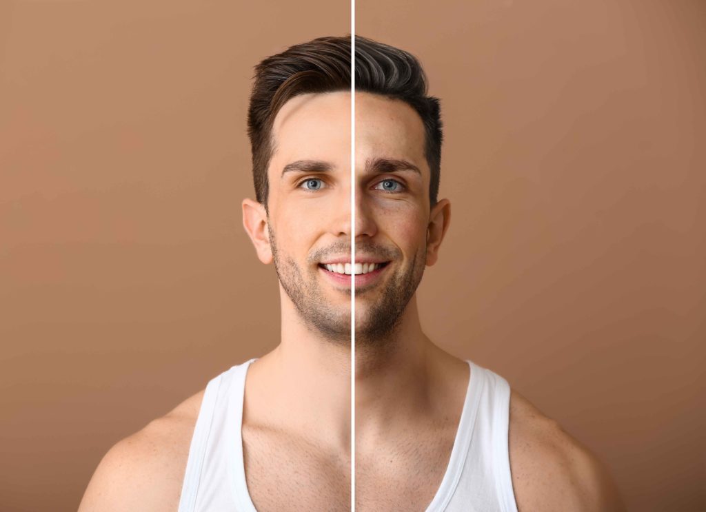 Facial Volume Loss Treatment in Lacey, WA | Rejuvenate Skin